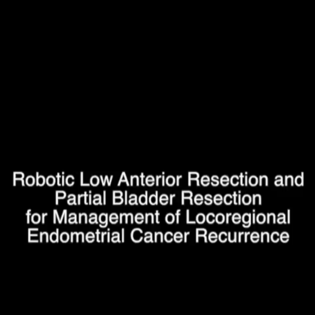 Gynecologic Oncologist & Minimally Invasive Robotic Surgeon | Dr ...